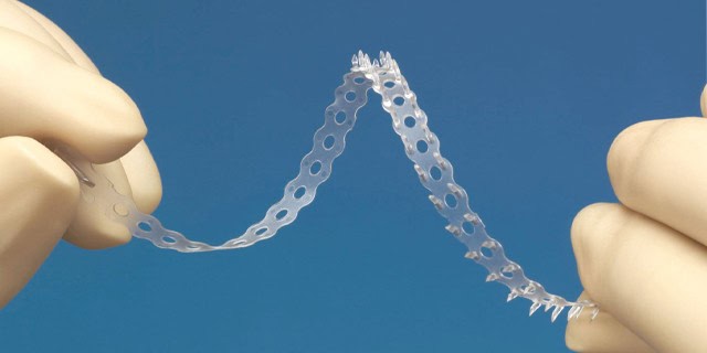 Endotine ยกกระชับปรับหน้าเด็ก โดยแพทย์ยศ