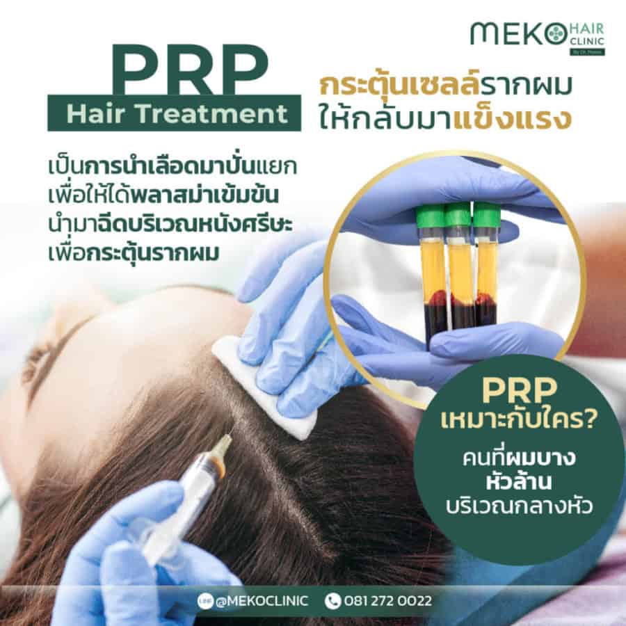 PRP Hair Treatment กระตุ้นเซลล์รากผมให้กลับมาแข็งแรง - Meko Clinic