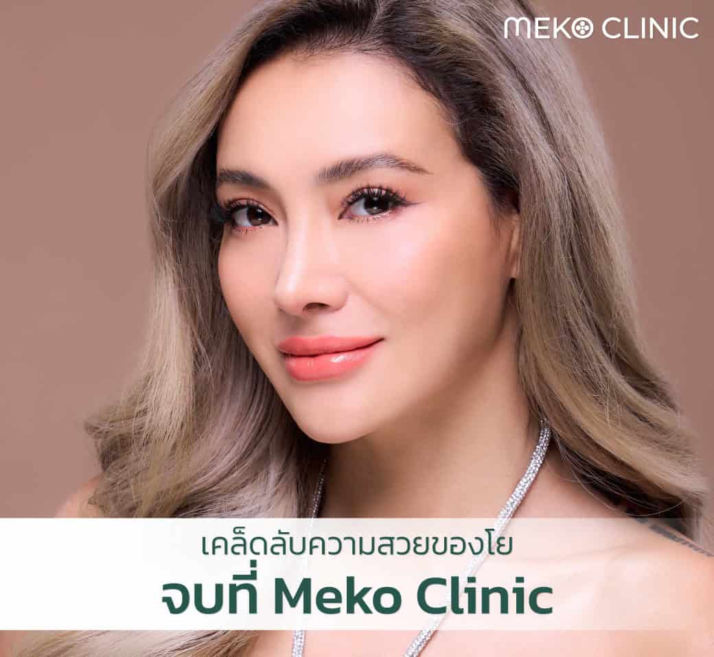 เคล็ดลับความสวยของโย ต้อง Sub Brow Lift ยกหางตาตก - Meko Clinic
