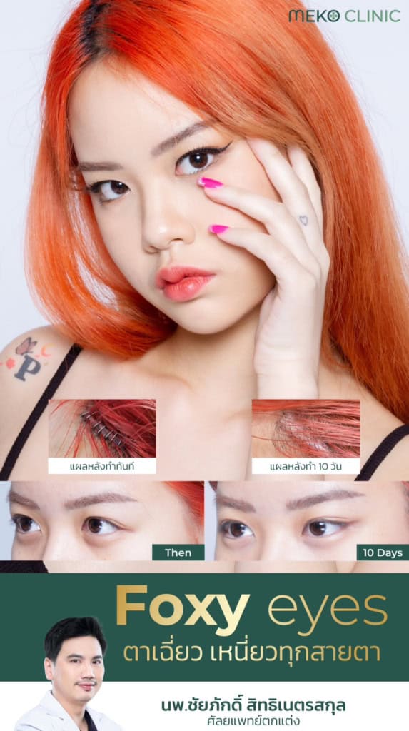 FOXY EYES ยกหางตาเฉี่ยว เปลี่ยนลุคเป็นสายฝ.1